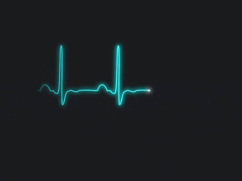 The EKG Guy